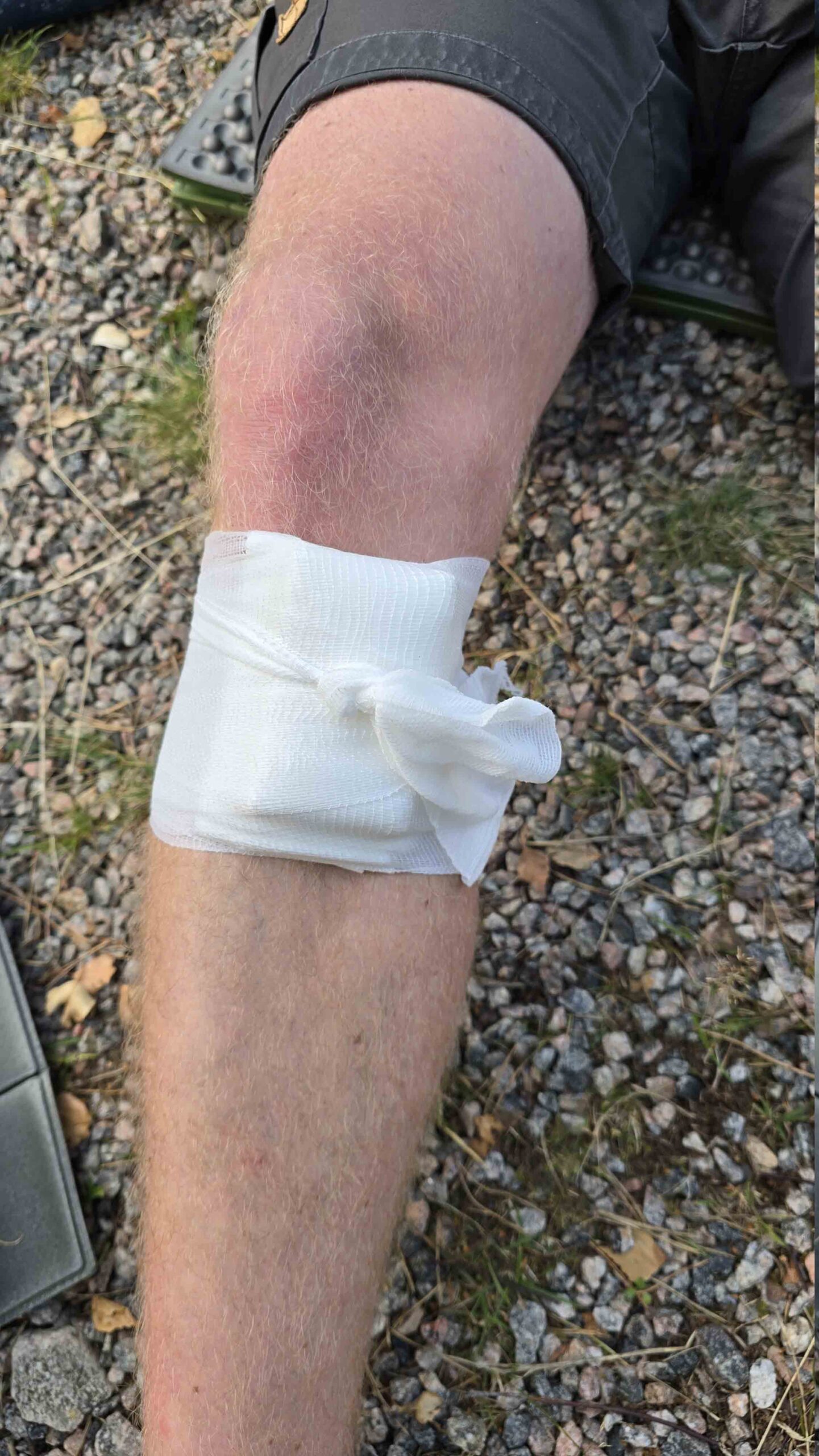 Wilderness First Aid – LXABCDE - Bushcraft Magazine